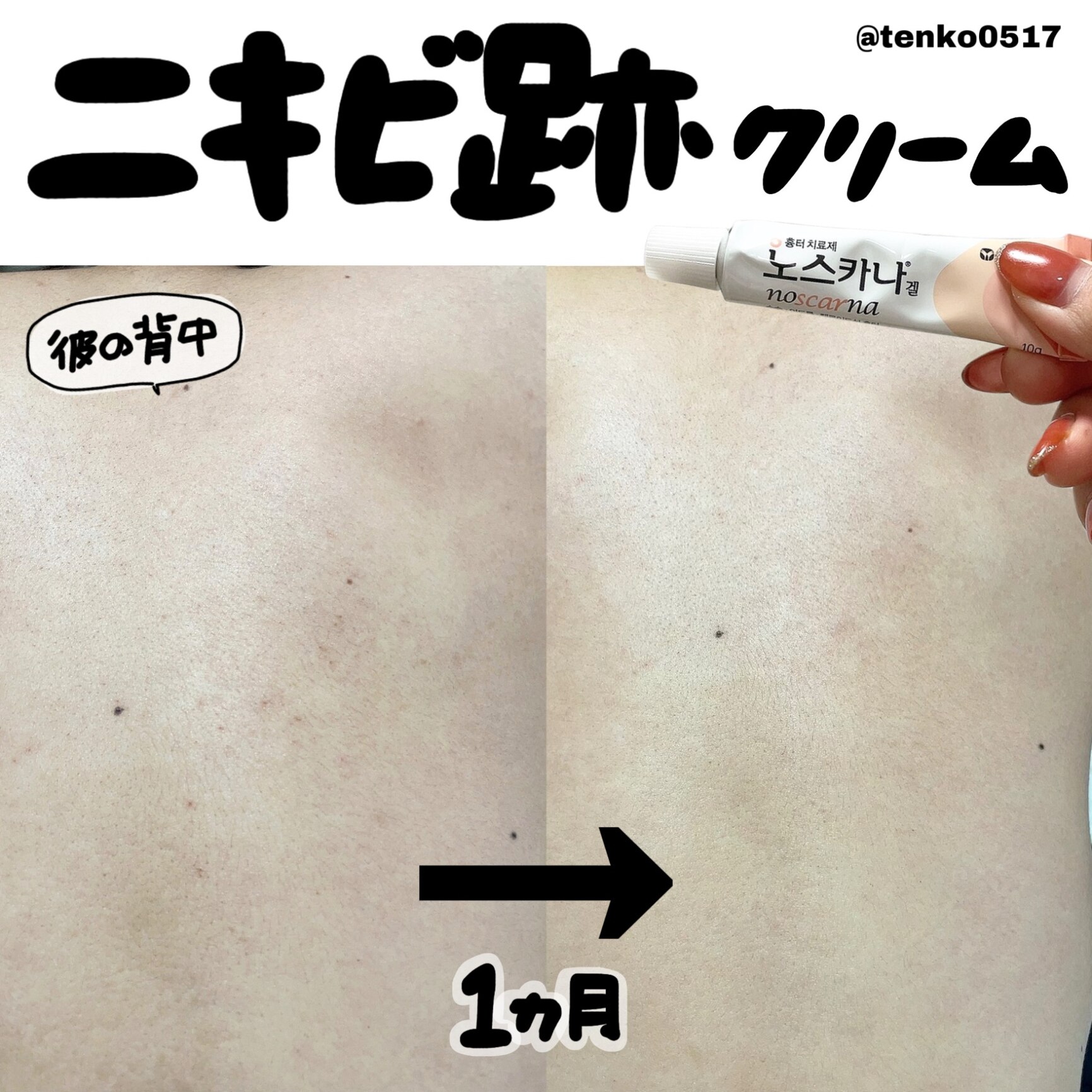 ★リニューアル ★GIFT [DONGA] ノスカナゲル / Noscana Gel (2023) - 10g / 正規品